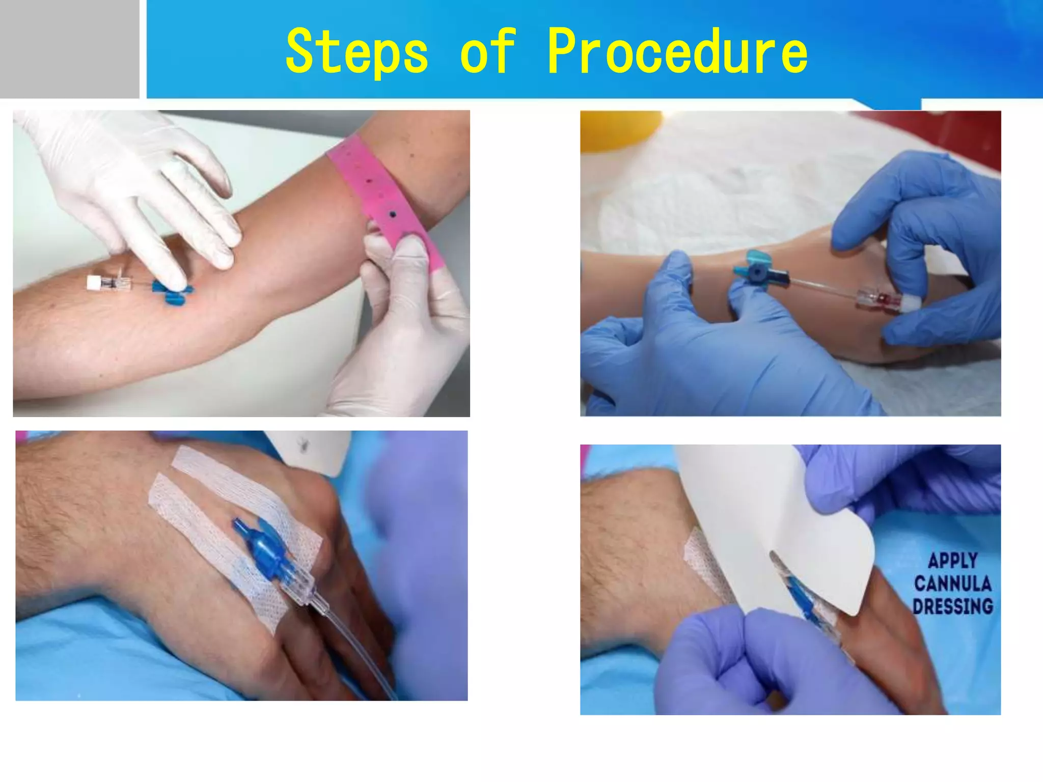 IV Cannulation.ppt