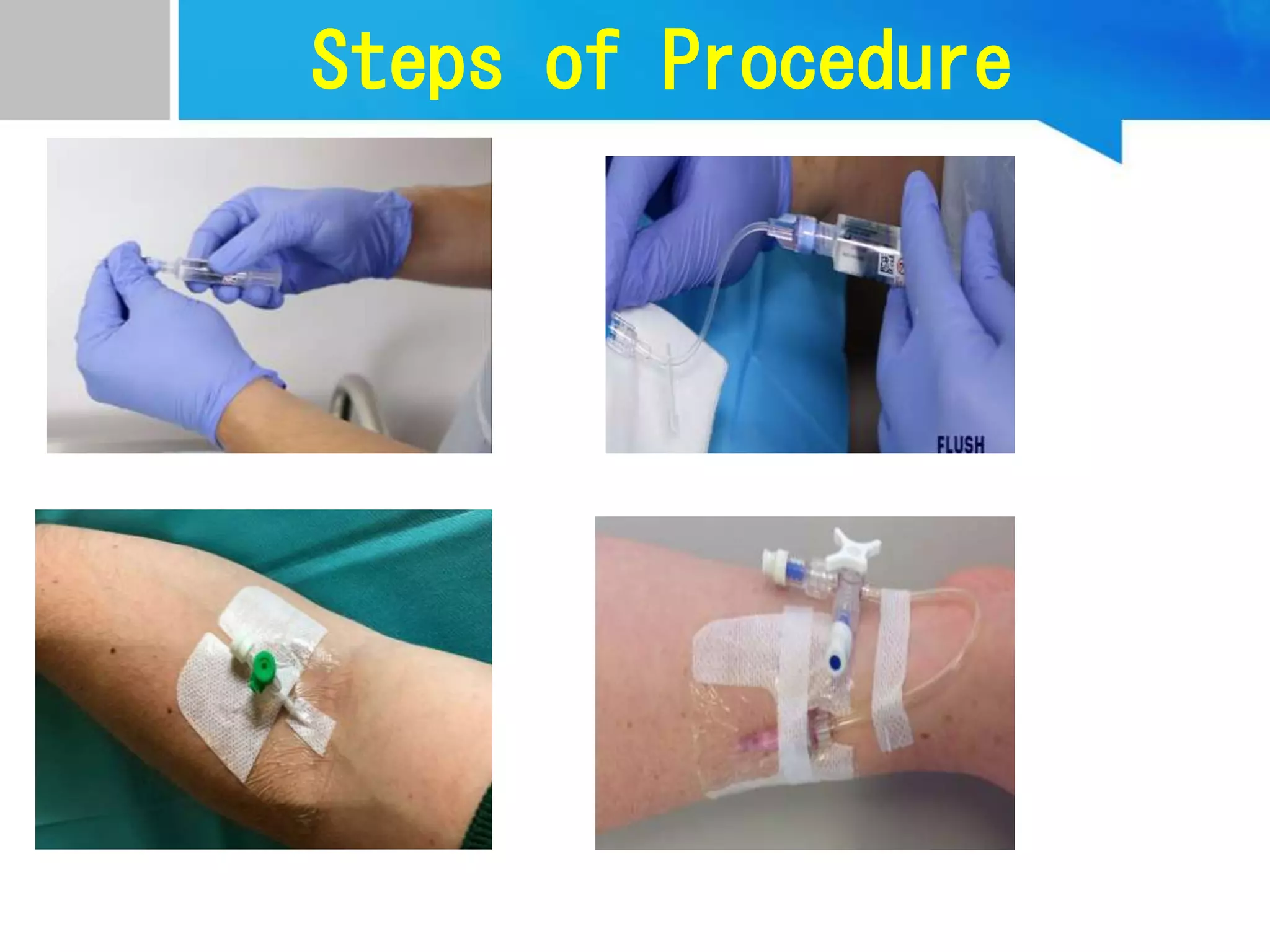 IV Cannulation.ppt