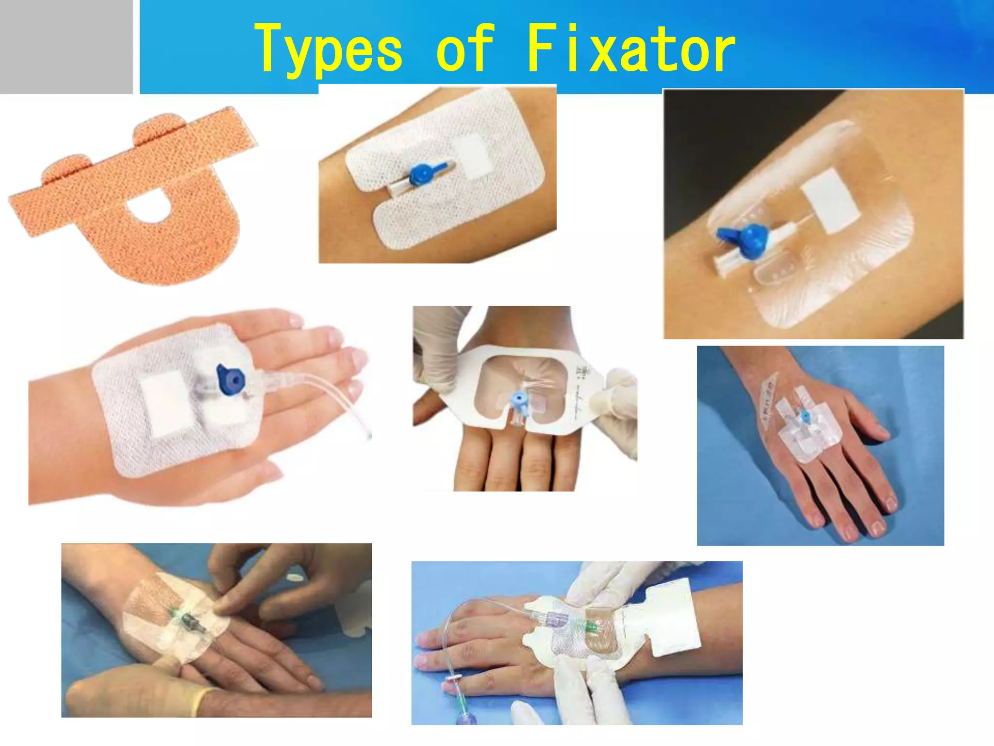 IV Cannulation.ppt