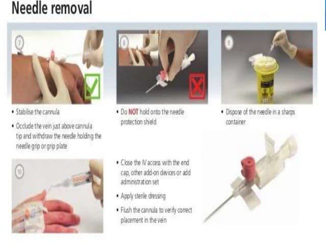 IV Cannulation.ppt | First Aid | Injuries