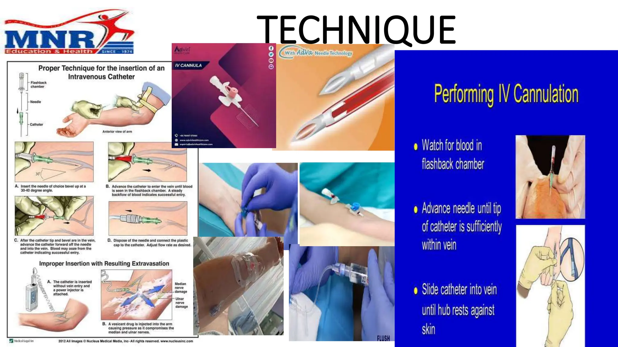 IV CANNULATION.pptx