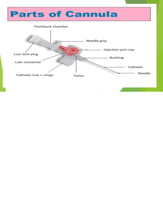 IV CANNULATION.pdf . How to insert iv cannula | PDF