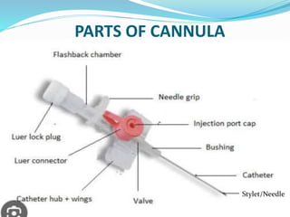 IV Cannulation Introducing a single dose of concentrated medication ...