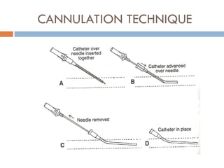 IV cannulation 2012.ppt for information and procedure on iv | PPT