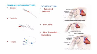 iv cannulation(central & peripheral)_023729.pptx | Blood Disorders | Diseases and Conditions