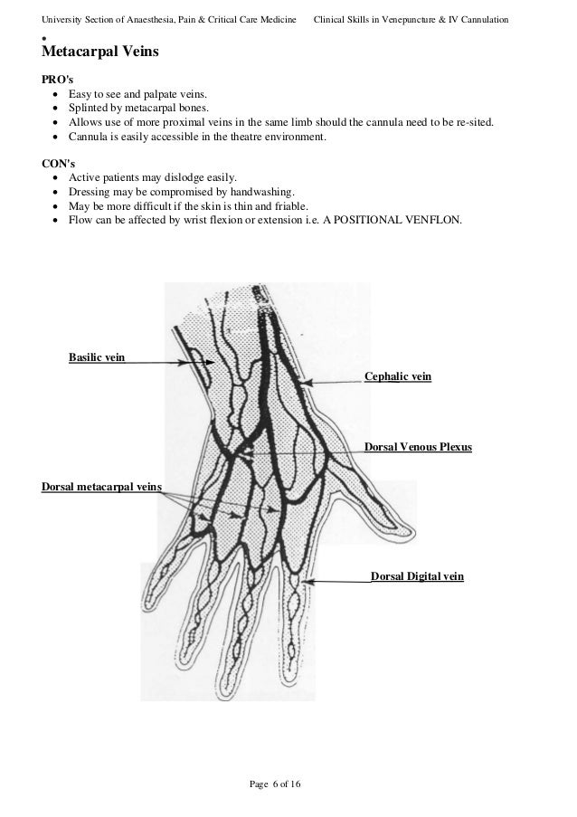 Iv cannulation sites