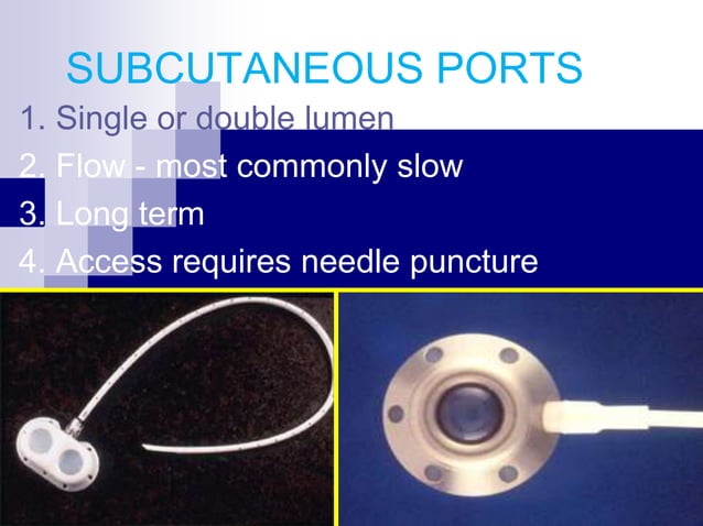 iv_catheter.ppt | First Aid | Injuries