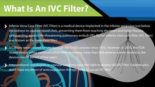 IVC Filter: A Clot Of Injuries & Lawsuits | Mass Torts Device - Neural ...