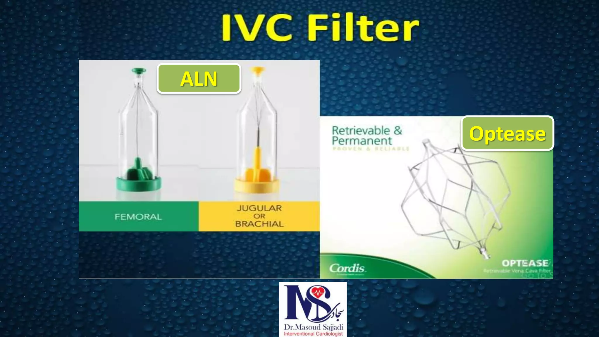 IVC Filter | PDF