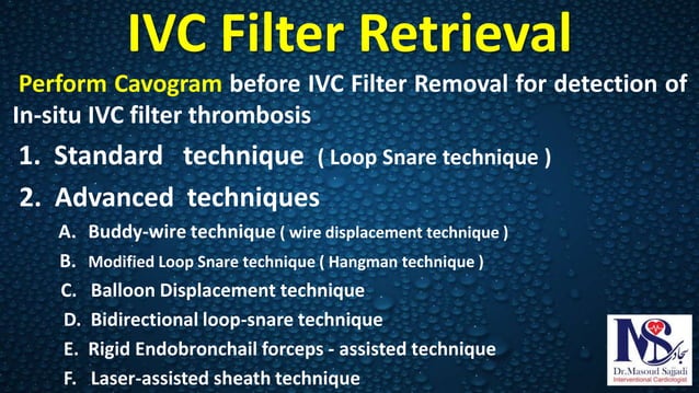 IVC Filter | PDF