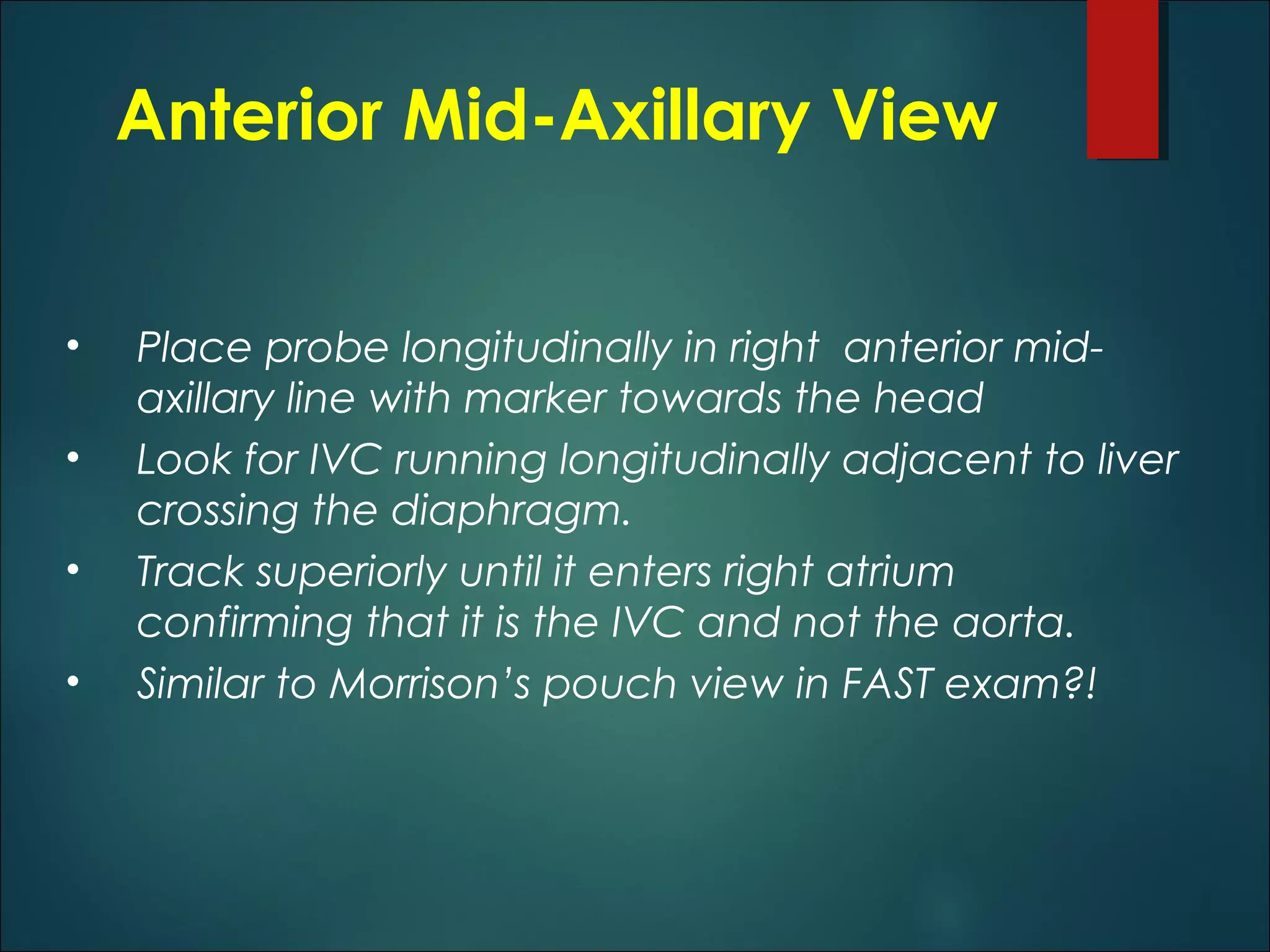 Ivc guided fluid management in the icu | PPT