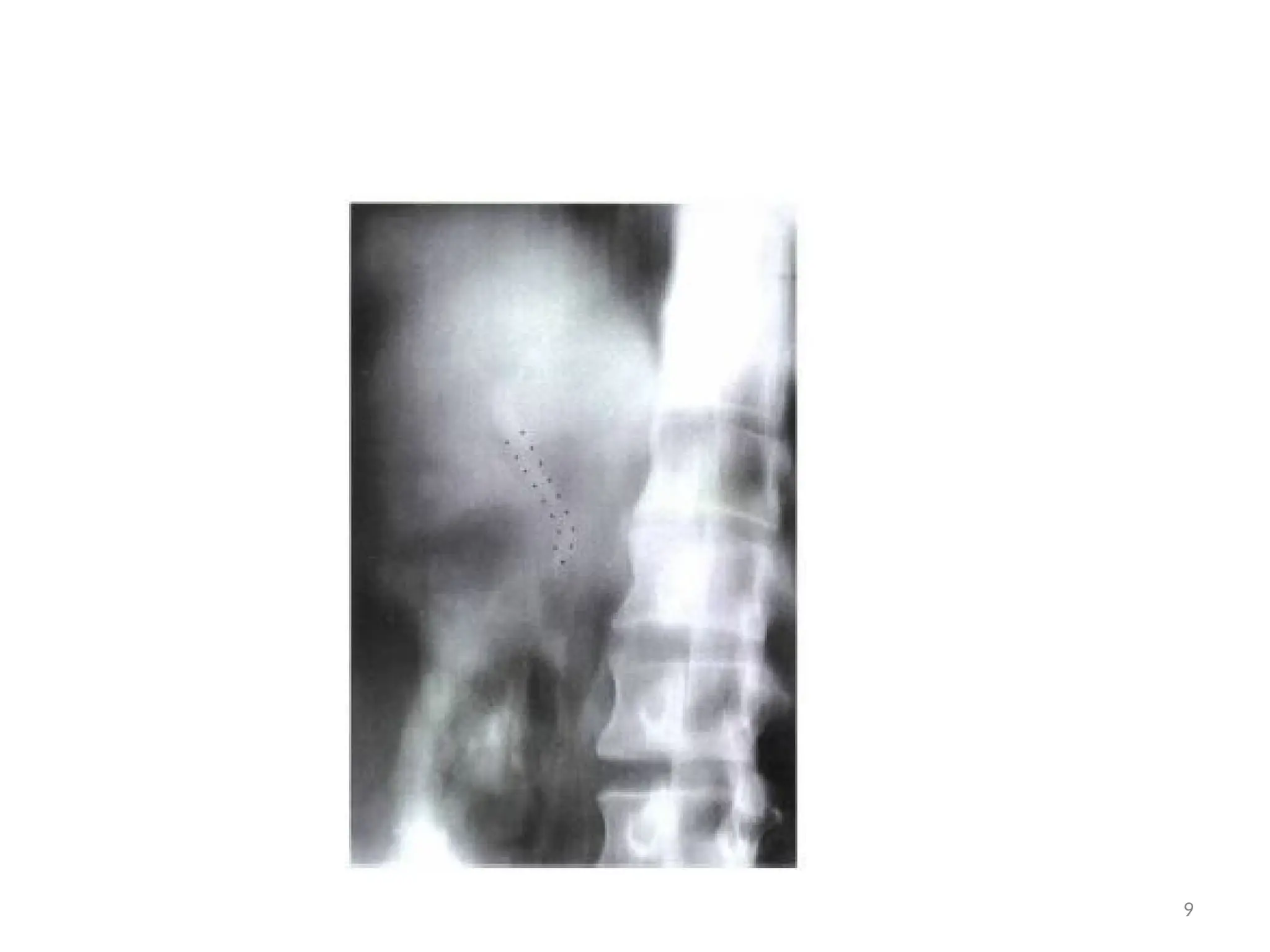 TOPIC MEDICAL IMAGING IV CHOLANGIOGRAPHY.ppt