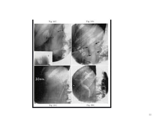 TOPIC MEDICAL IMAGING IV CHOLANGIOGRAPHY.ppt