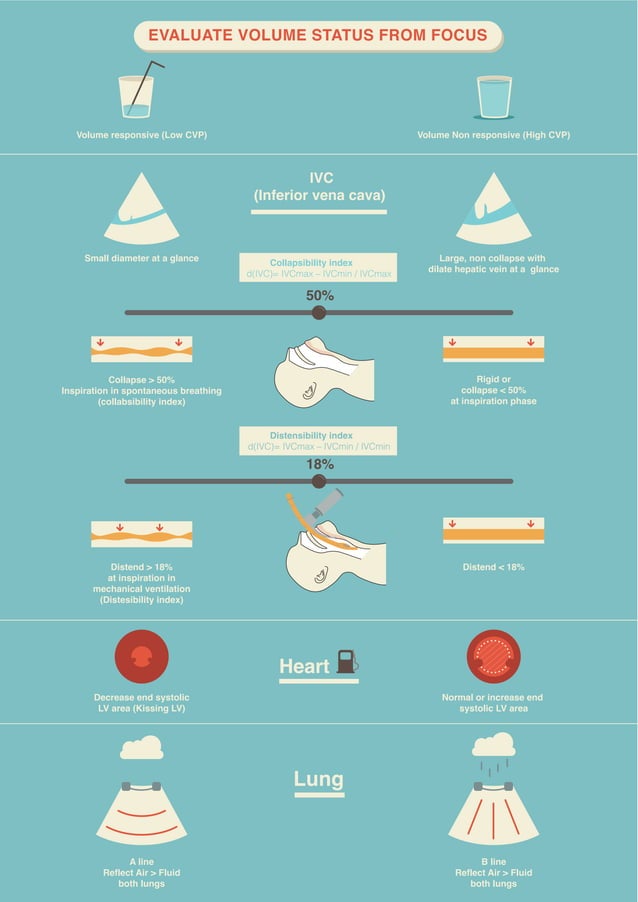 Ivc summary infographic | PDF