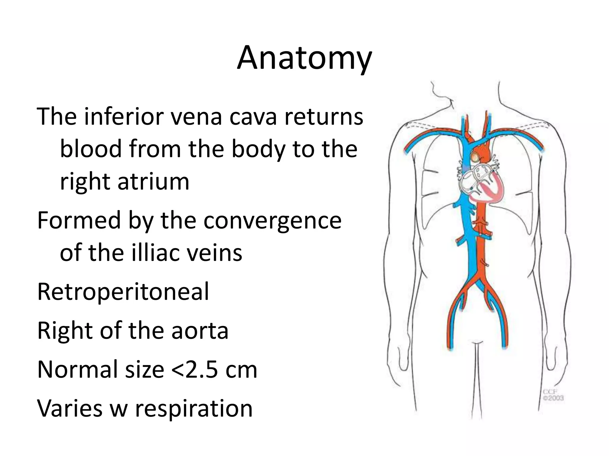 IVC Ultrasound | PPTX