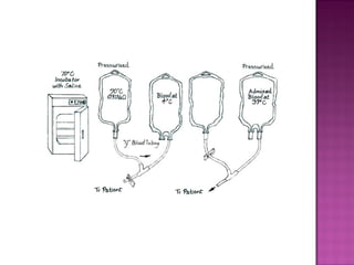 Iv delivery system | PPT