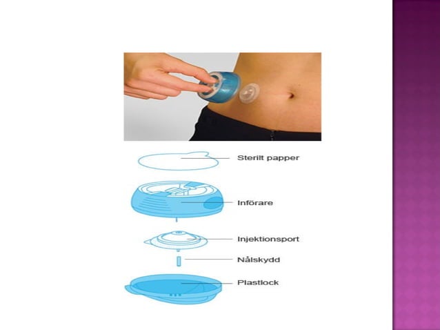 Iv delivery system | PPT