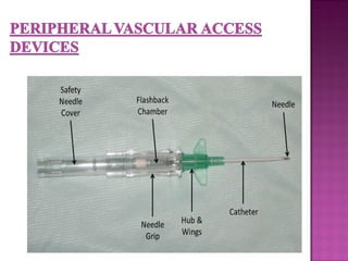 Iv delivery system | PPT
