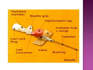 Iv delivery system | PPT