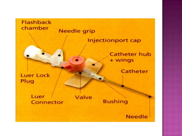 Iv delivery system | PPT
