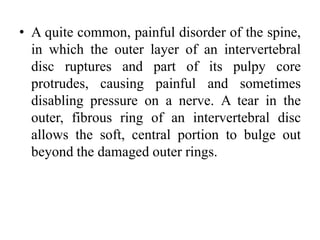intervertebral disc prolapse | PPSX