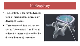 Inter vertebral disc prolapse | PPTX