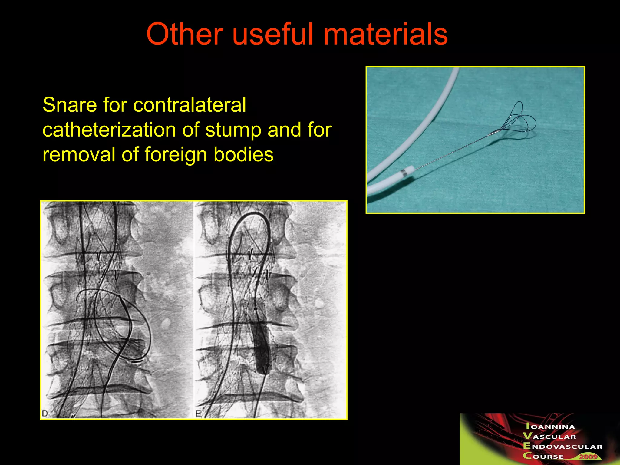 Choosing catheters & guidewires | PPT | Heart and Cardiovascular ...