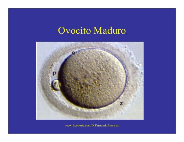 Fertilización In Vitro