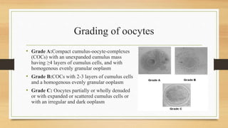 Invitro-fertilization (IVF) | PPTX