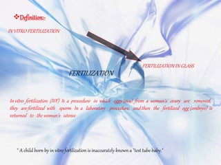 in vitro fertilization | PPT