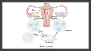 In vitro fertilization | PPTX