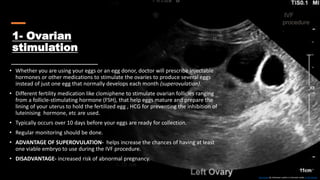 In vitro fertilization | PPTX