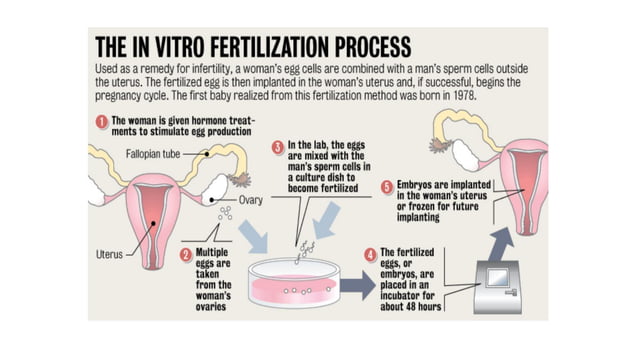 IN VITRO FERTILISATION IVF IVF.PDF INVITRO | PPT