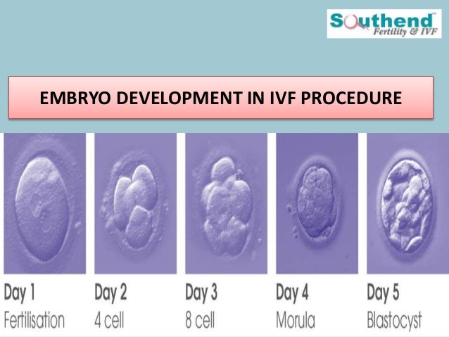 Ivf in vitro fertilization