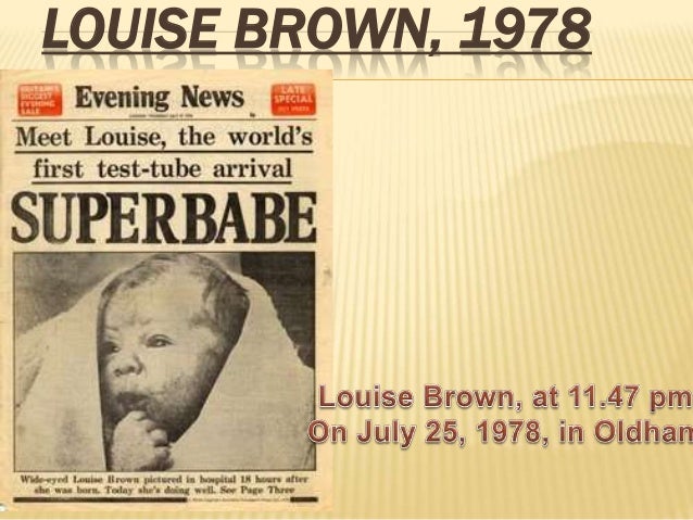 Ivf - In Vitro Fertilization