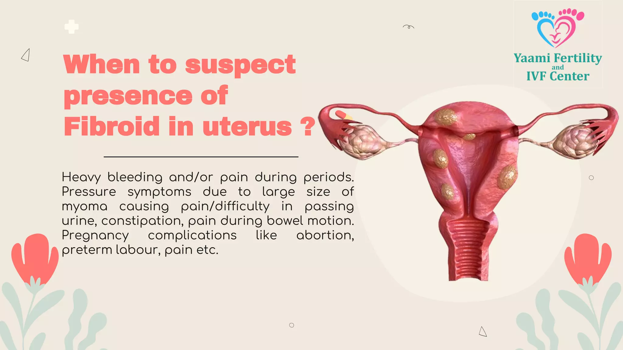 IVF CENTER IN INDORE Fibroid.pdf
