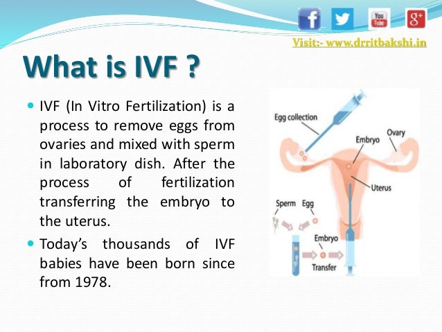 IVF Clinic in Delhi - Best IVF Treatment Centre in India
