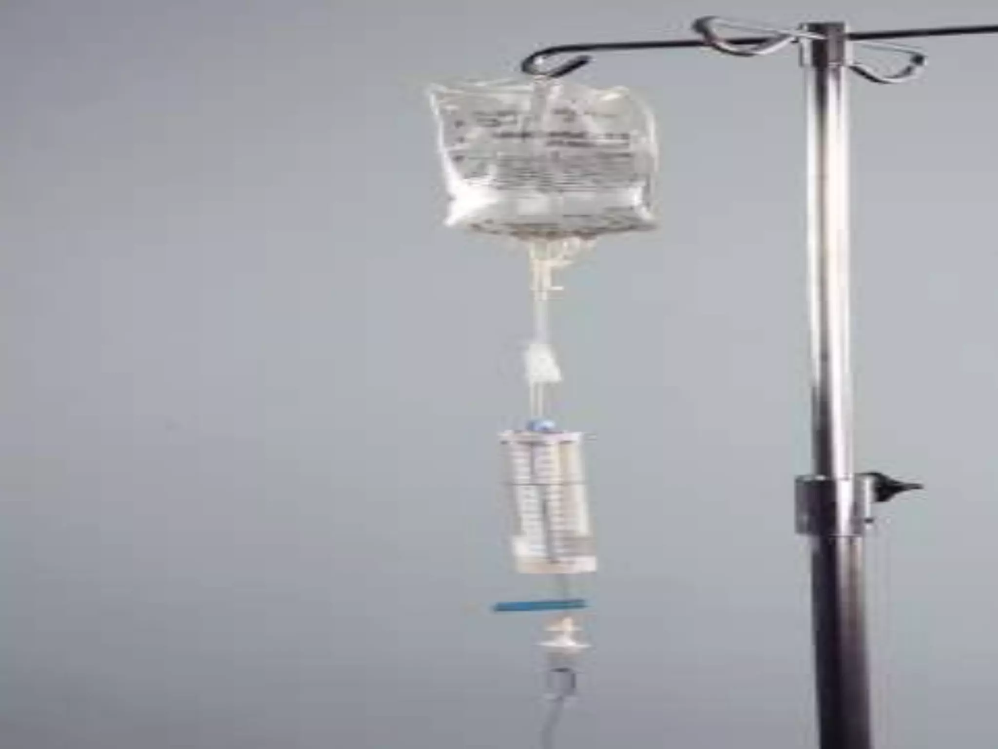 Iv fluid infusion | PPTX