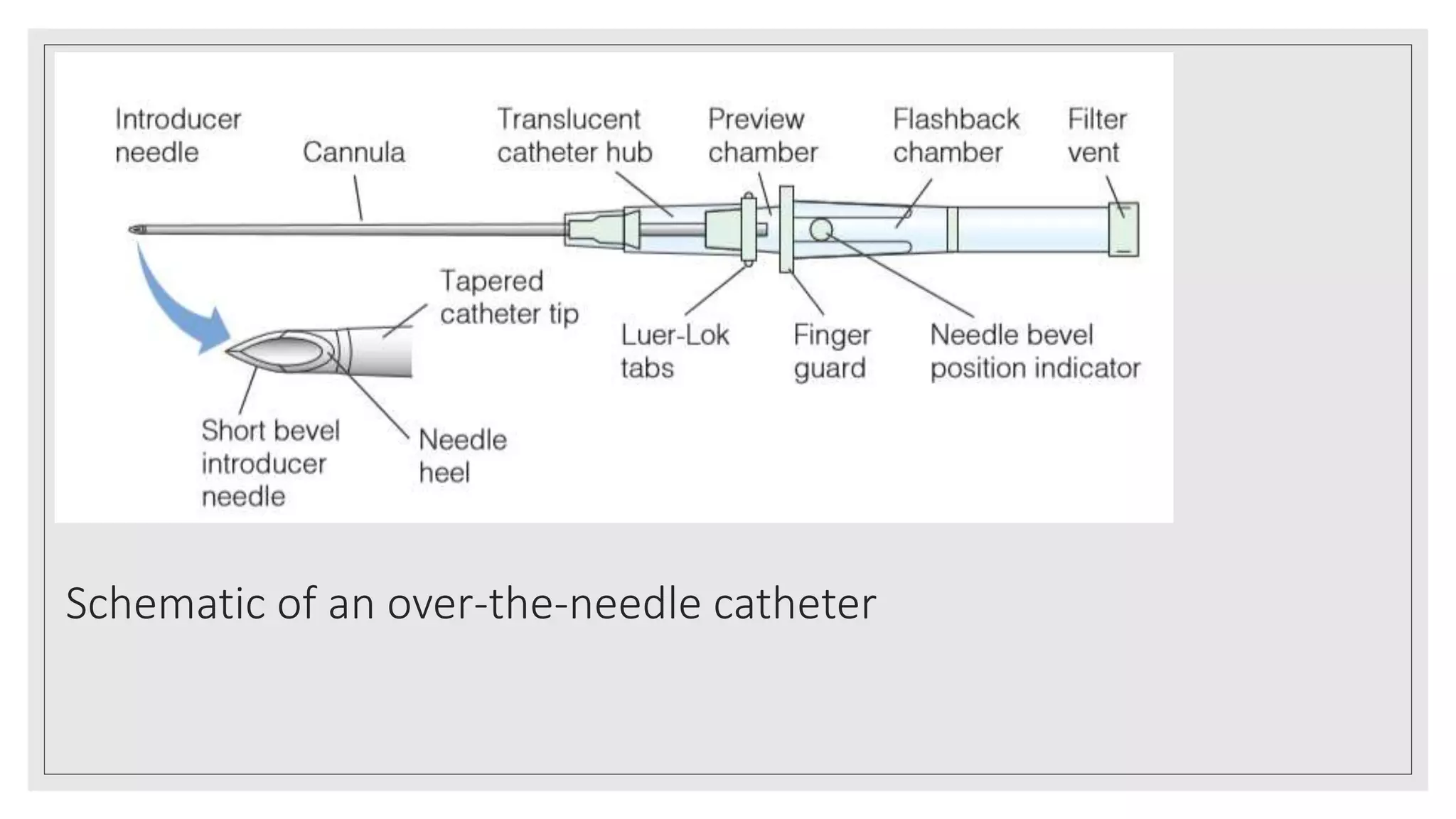 IV Fluids Clinical Discussion | PPTX