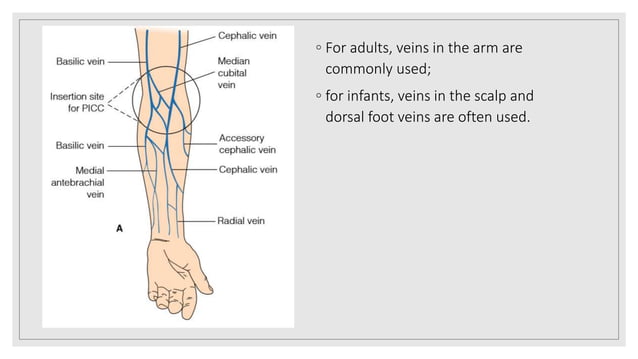 IV Fluids Clinical Discussion | PPTX