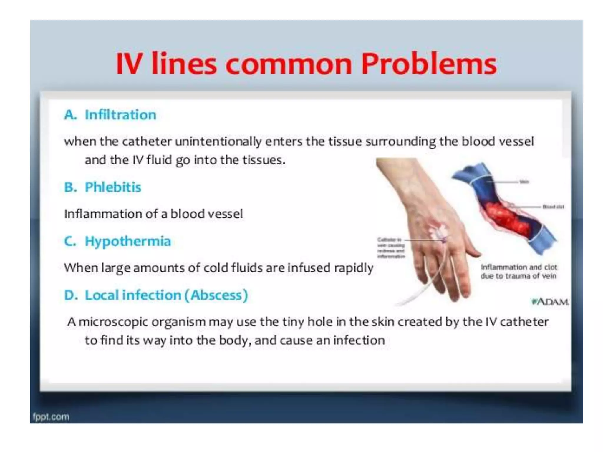 IV FLUID THERAPY ppt.pptx