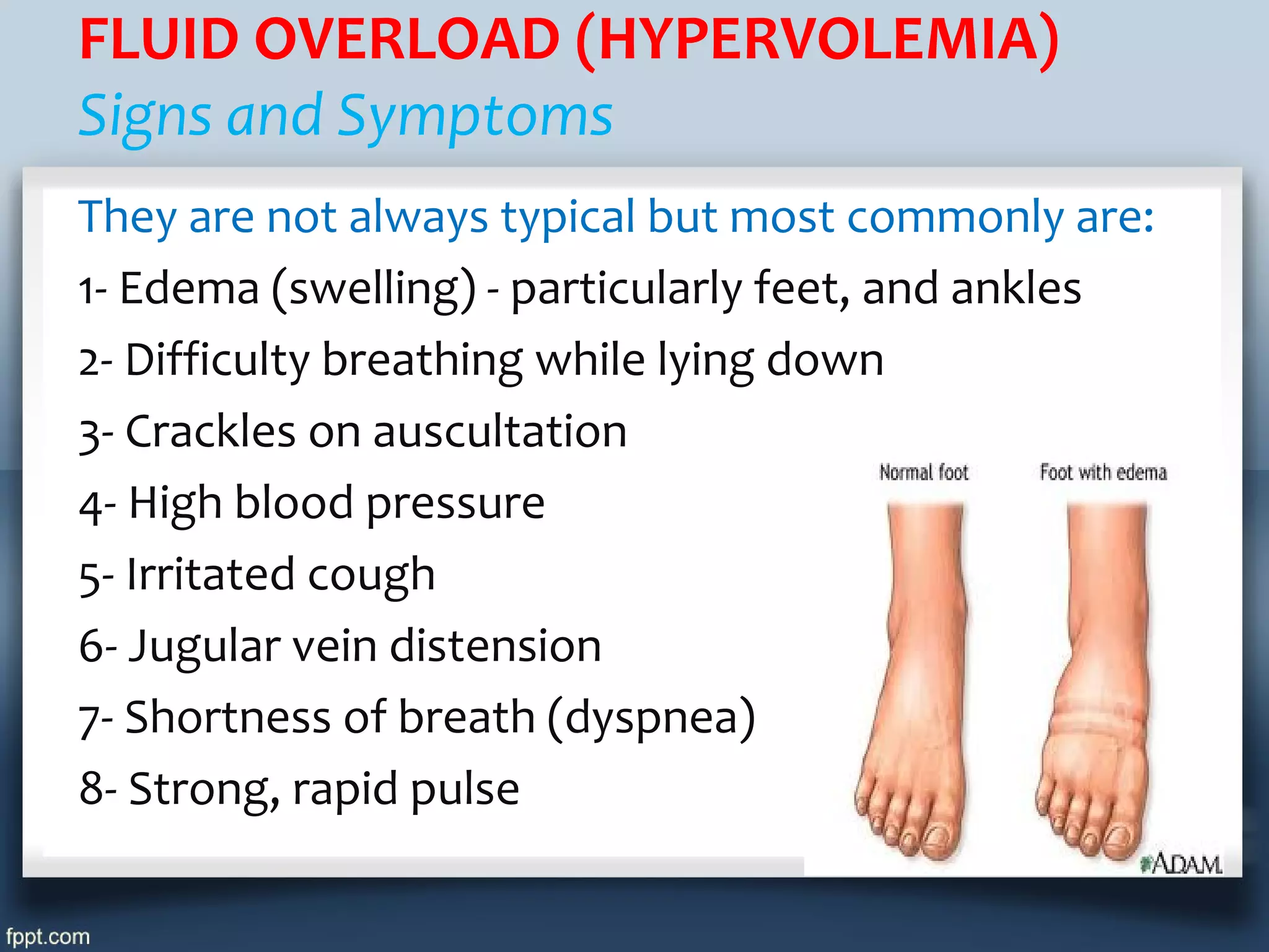 Iv fluid therapy (types, indications, doses calculation) | PPT