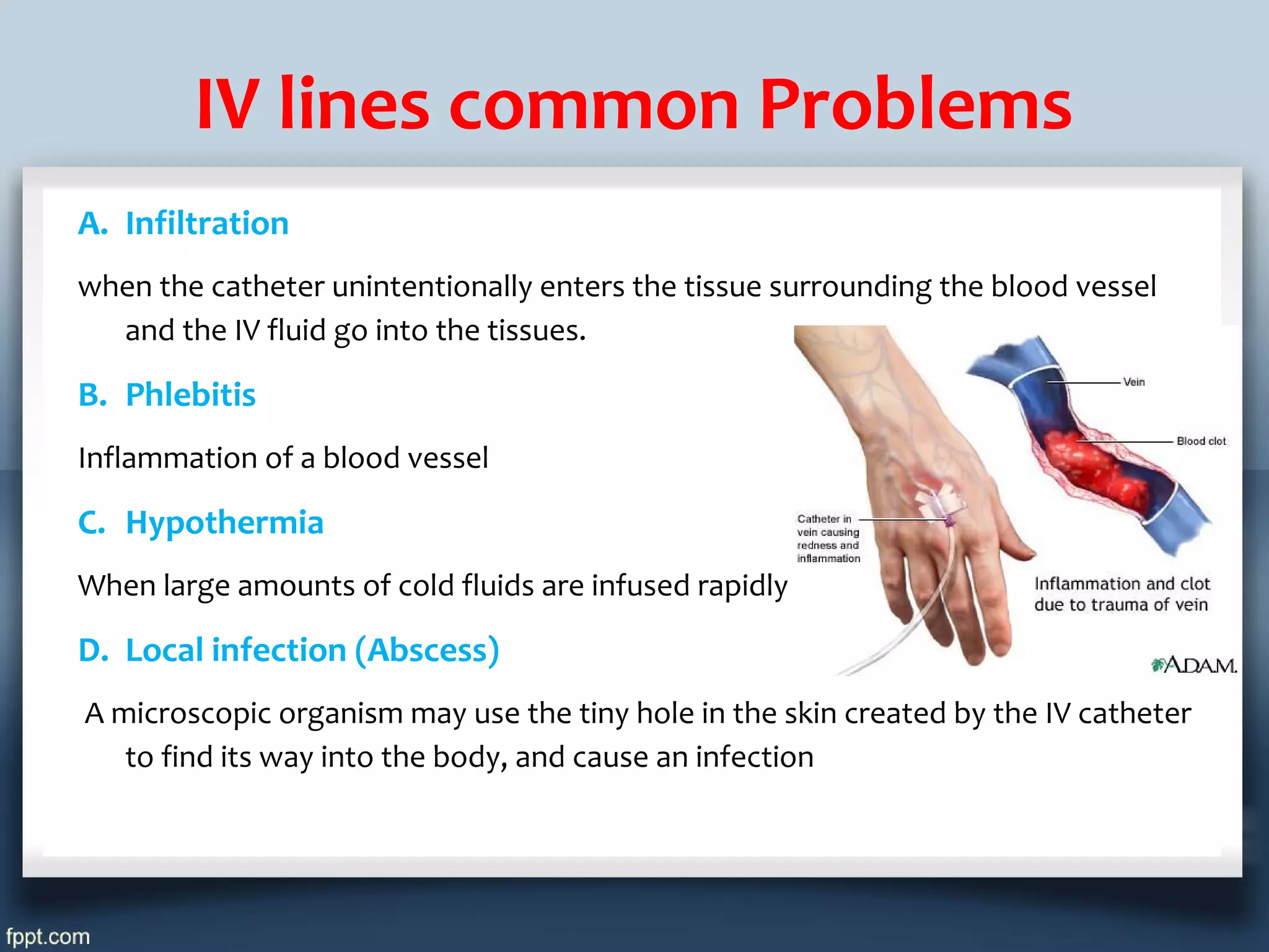 Iv fluid therapy (types, indications, doses calculation) | PPT