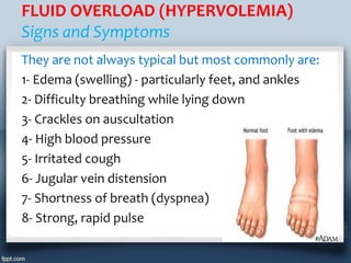 Iv fluid therapy (types, indications, doses calculation) | PPT