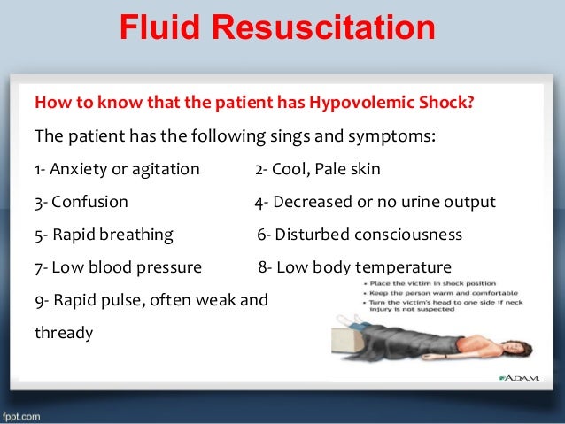 Iv fluid therapy (types, indications, doses calculation)