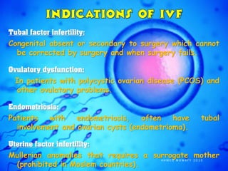 In vitro fertilization and embryo transfer "IVF"; Overview on the Story ...