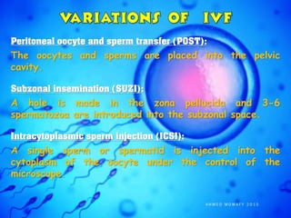 In vitro fertilization and embryo transfer "IVF"; Overview on the Story ...