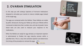 Ivf patient guide, most common questions for IVF patients.pptx