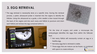 Ivf patient guide, most common questions for IVF patients.pptx