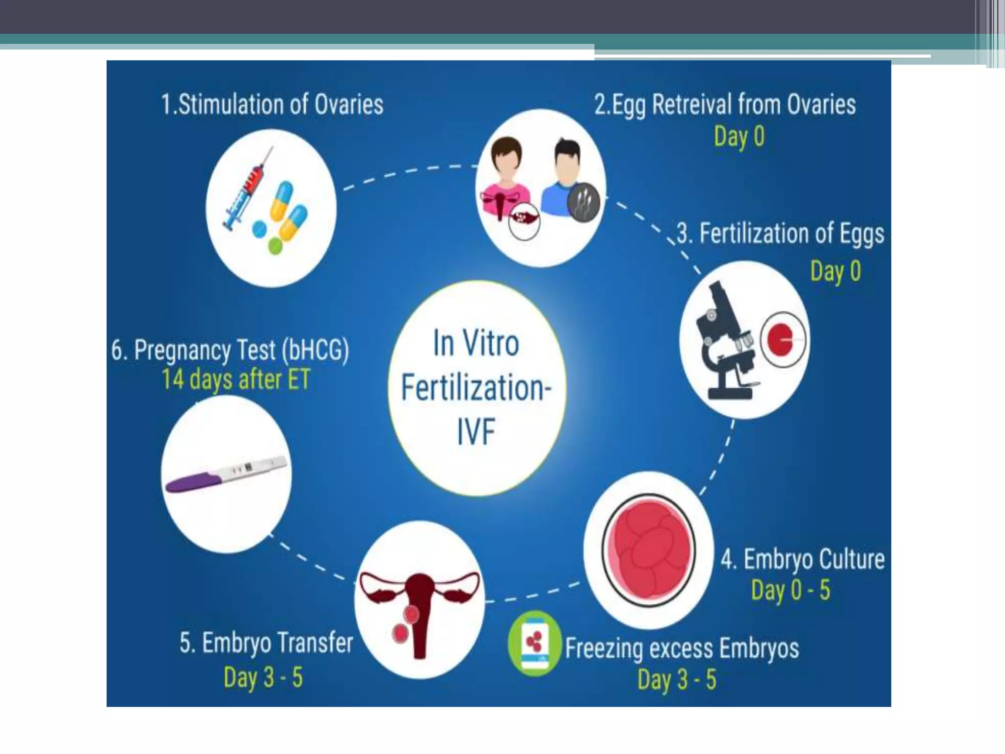 Invitro fertilization in humans(IVF) | PPTX